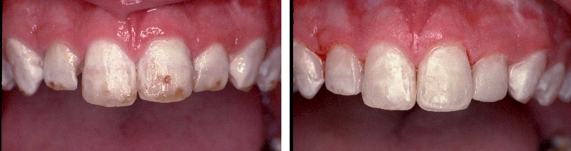 Index of /blanqueamiento